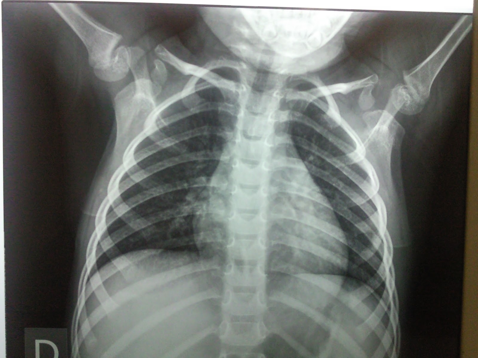 Blog de Atención Primaria