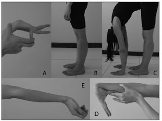 Fisioterapia em Traumato-Ortopedia Baseada em Evidências ...