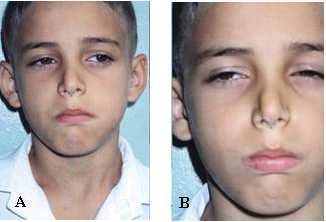 Semiología Quirúrgica: Las facies (Clase teorica lunes 30 de mayo)