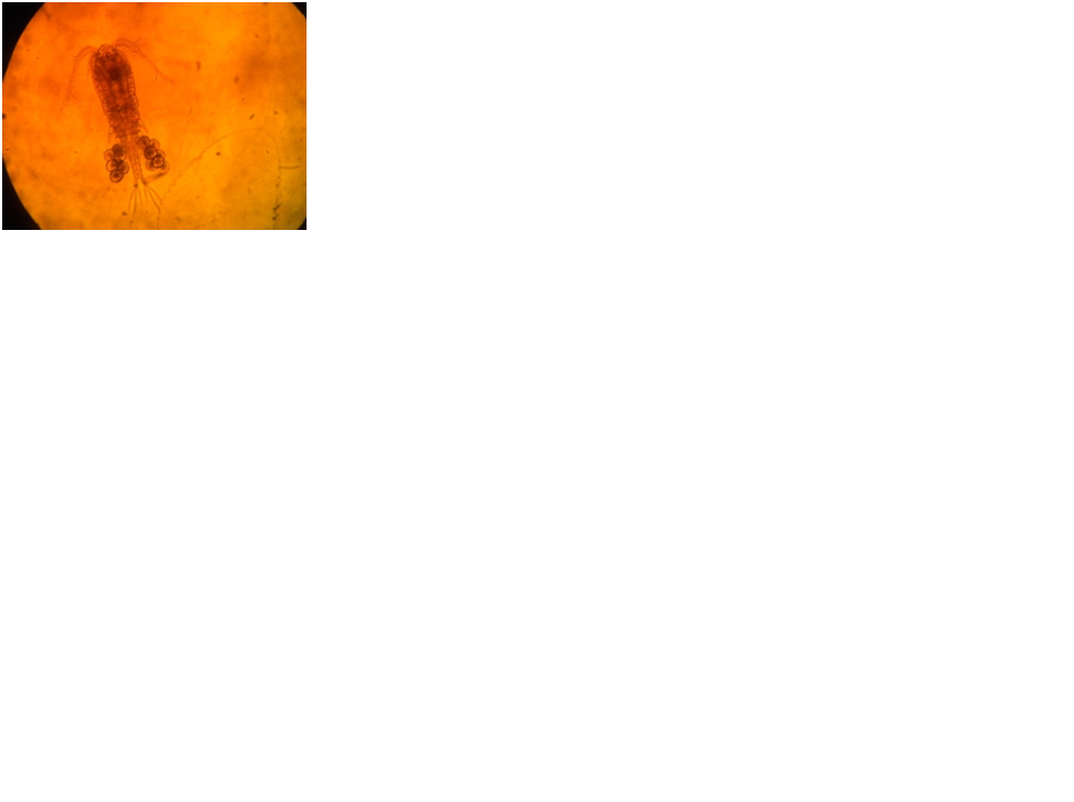 Belajar Biologi: Klasifikasi dan karakteristik cylops sp