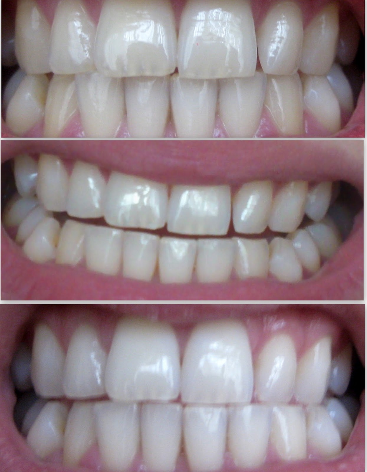 Lipstick Attack: Crest 3D White proffesional effects trakice