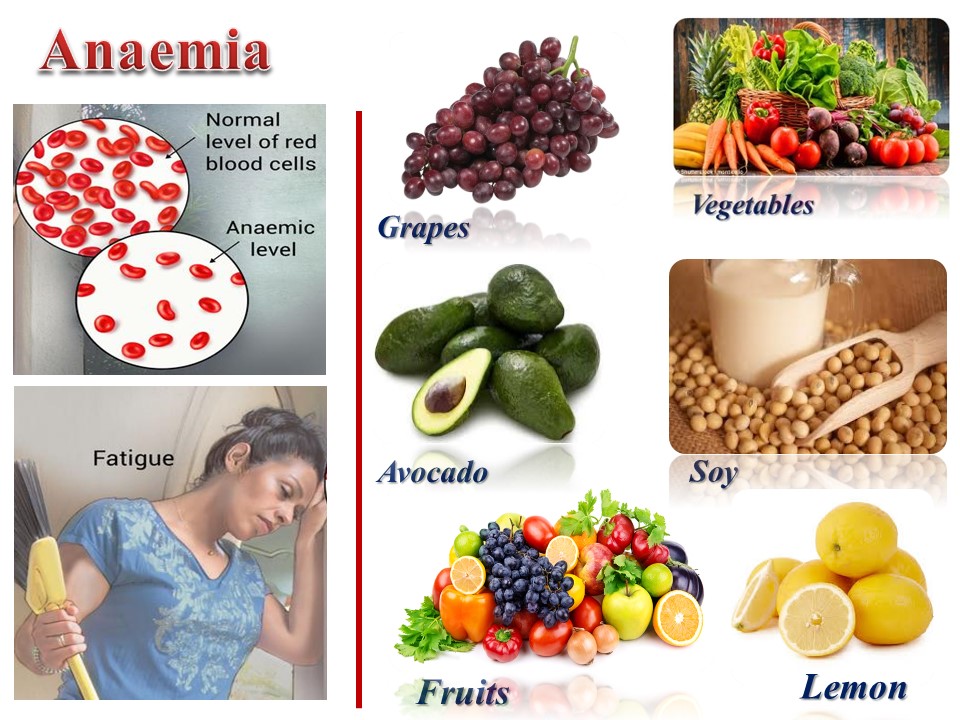 Anaemia