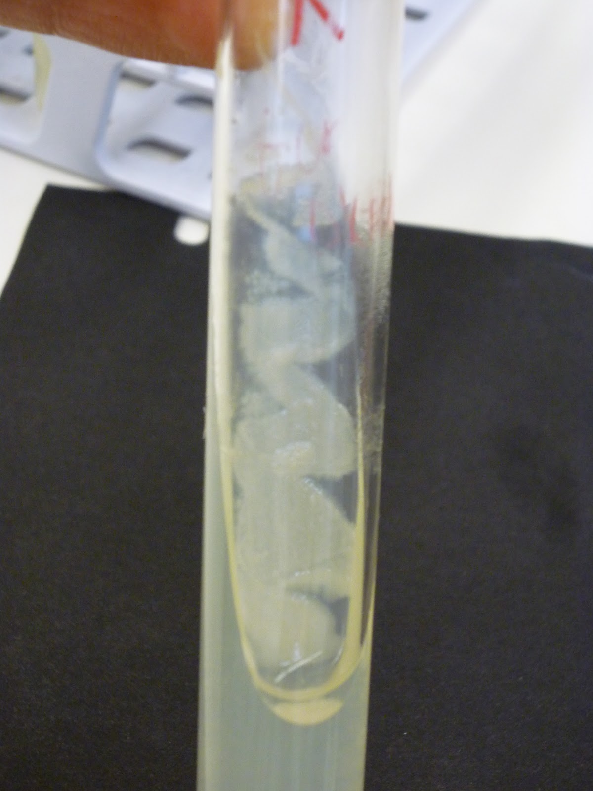 Medical Microbiology: November 8-10