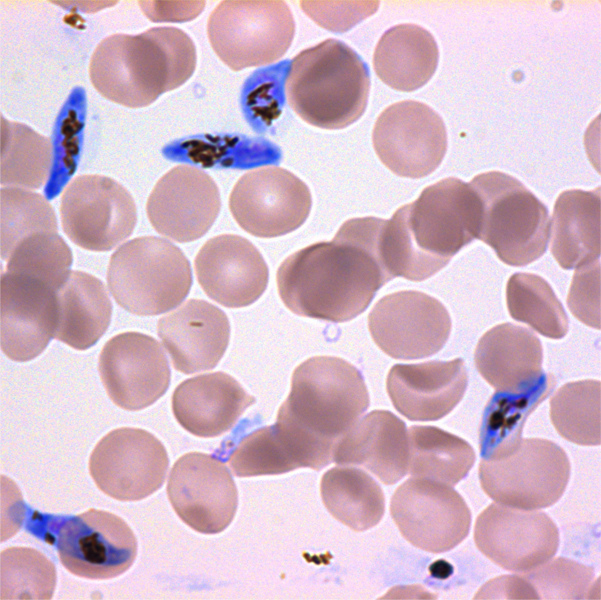 Plasmodium falciparum - Microbiology Laboratory Turkey
