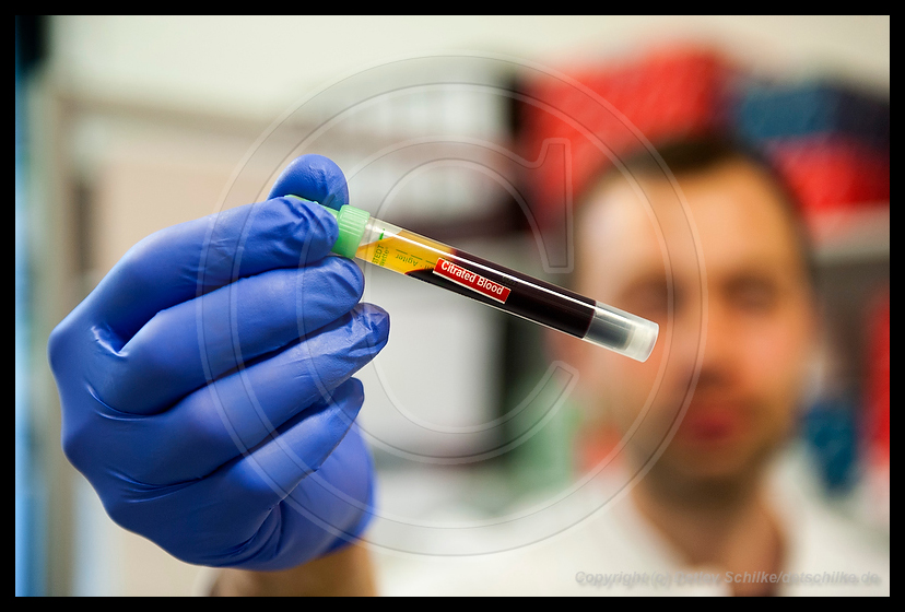 The EyeCatcher Blog: Citrated Blood