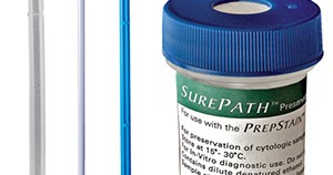 Ob/Gyn Updated : FDA approves Roche’s COBAS HPV Test for use with ...