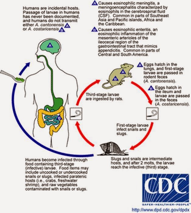 Medicina hermosa vocación.: Meningitis eosinofílica por Angiostrongylus ...