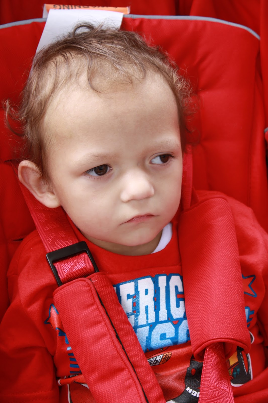 Keeping Up with Tiny Titan: The Face of Fetal Alcohol Syndrome. The ...