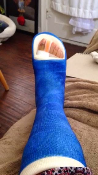 The Bloomin' Bunion: Bunion Surgery & Recovery Blog: Bunion Surgery ...