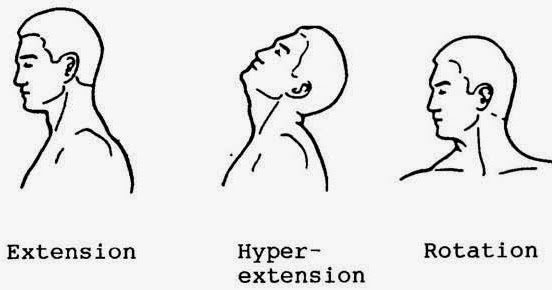 Arc4life's Natural Pain Relief Blog for the Neck and Low Back: A look ...