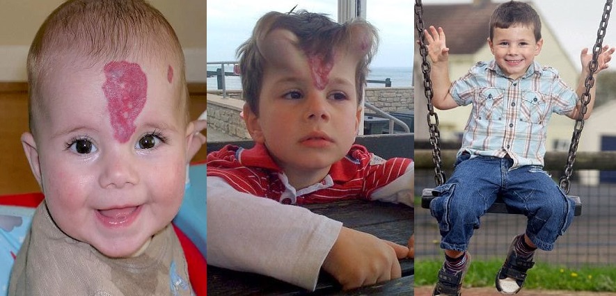 World For Anon: People With Their Strange Birth Marks