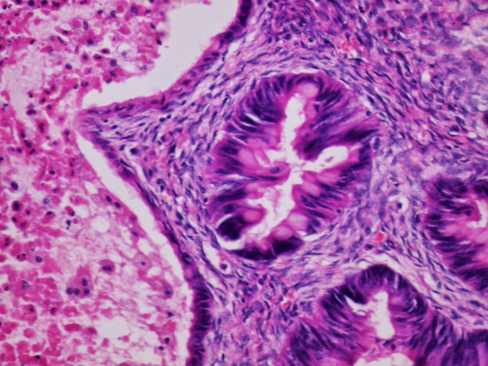Neoplasm Neoplasm Journal neoplasm-neoplasm-journal