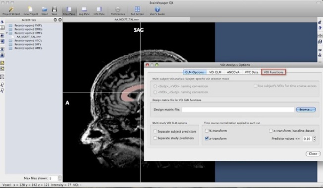 Neuroimaging Made Easy : Brainvoyager QX tips and tricks 2; Create a 3d ...