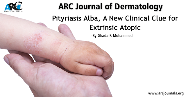 Pityriasis Alba, a New Clinical Clue for Extrinsic Atopic Dermatitis ...