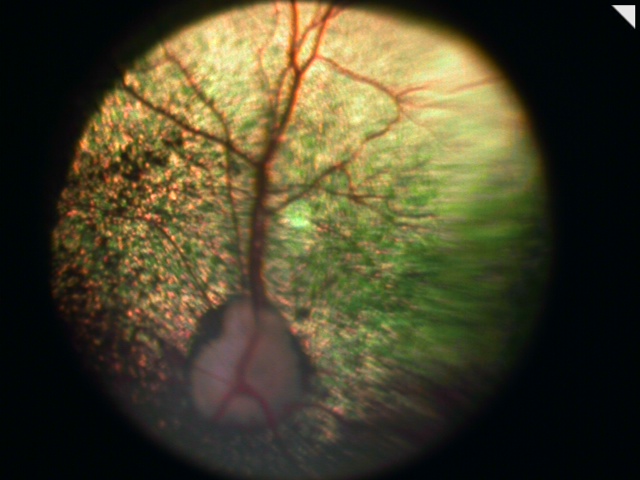 Taco Belle Times: "Tails" of a Baby Boomer Veterinarian: RETINAL ...