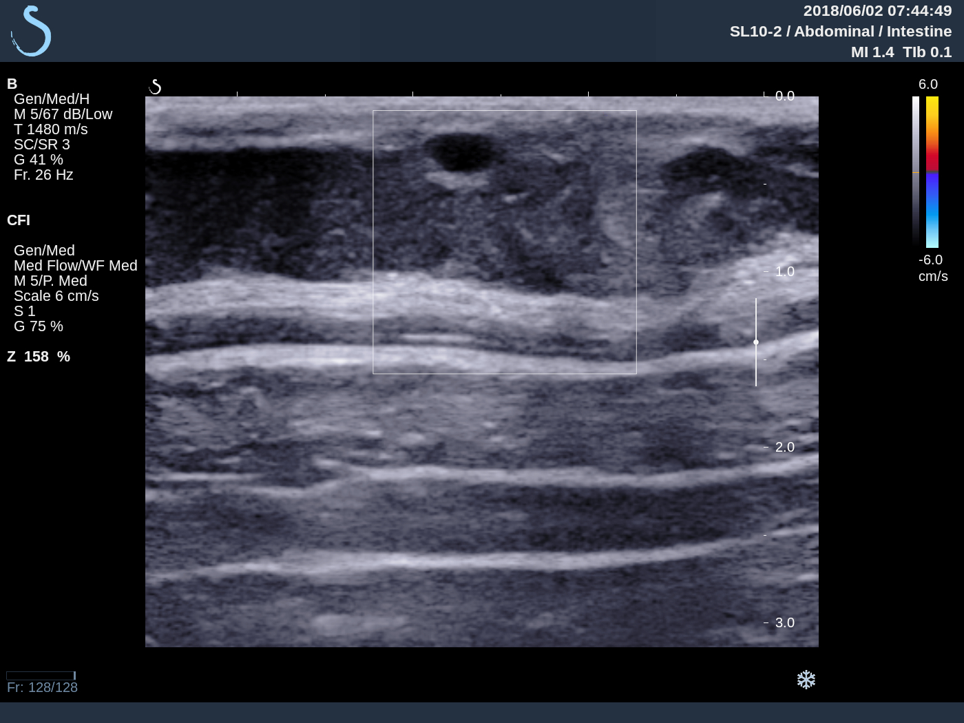 VIETNAMESE MEDIC ULTRASOUND: CASE 497: MULTIPLE SKIN LESIONS AND ...