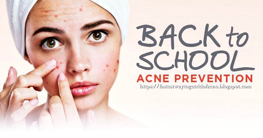 An Easy Way to Prevent Acne | How to prevent pimples - Fastest Way to ...