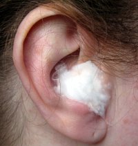 Cough-Cold & a child with DS