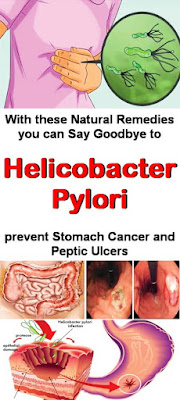 Natural Treatment for Helicobacter Pylori - healthymasters