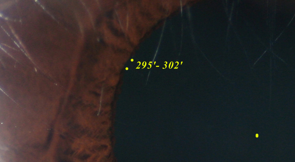 Modern & Multidimensional Iridology: The Collarette Structure & Signs ...