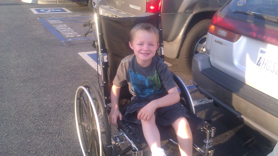 Jeremy's journey with Legg-Calve-Perthes disease: and the casts are off.
