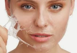 Isabel Medical Day Spa - Blog: Nowy zabieg Purles Kwas TCA ...