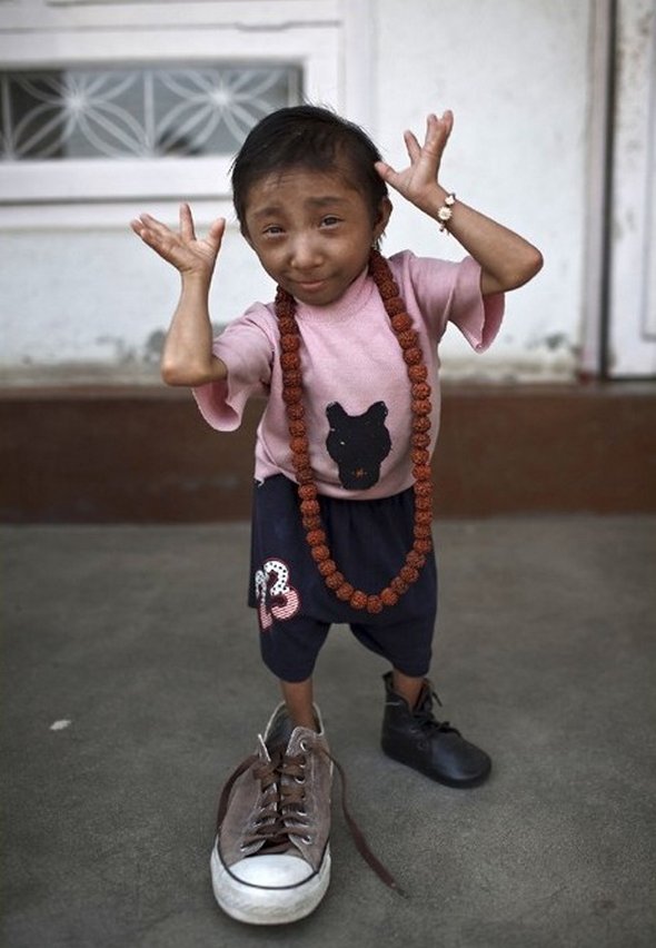 OMG World: OMG! Smallest Man In The World From Nepal