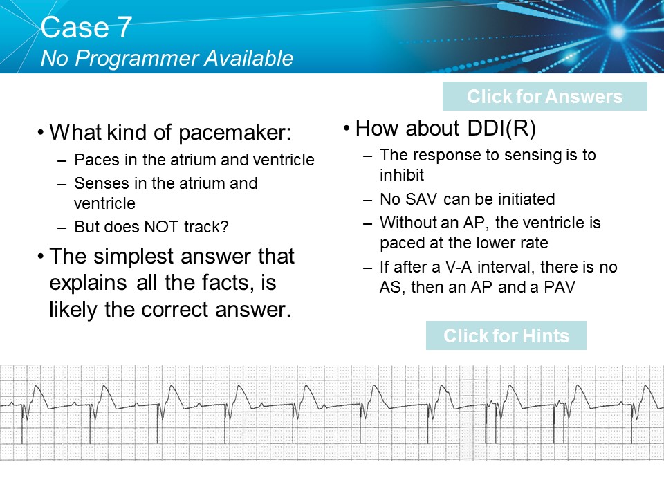 CVT Mohd Farid: Basic Pacemaker Troubleshooting Part II-Medtronic Academy