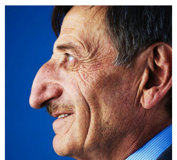 Check out viral photos of the man with the longest nose in the world ...