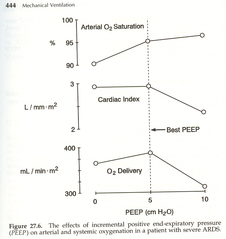Pedi cardiology: Cardiopulmonary interactions