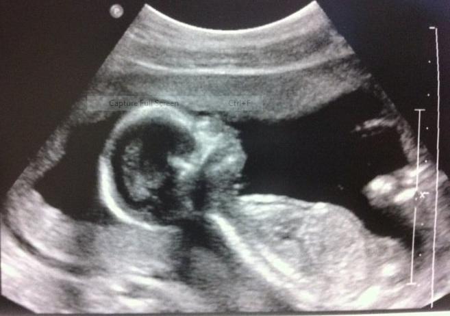 Dedicated to Our Family: 33 weeks