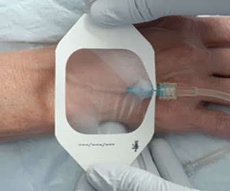 Initiating a Peripheral IV Infusion ~ Nursing
