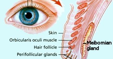 Look4Optical: Understanding Meibomian Gland Dysfunction and What to do ...