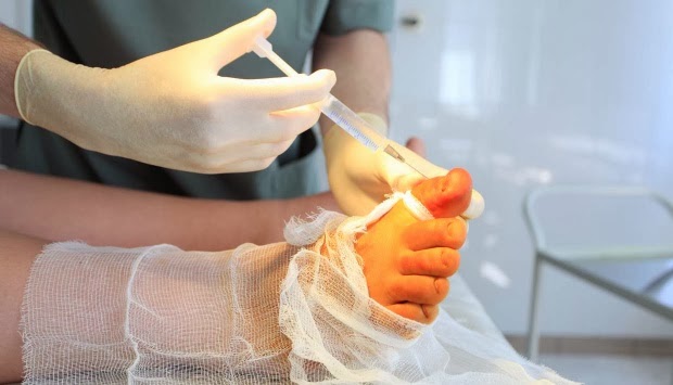 Stem Cell Therapy in Diabetic Foot Case - HEALTHY SNACKS BRAND