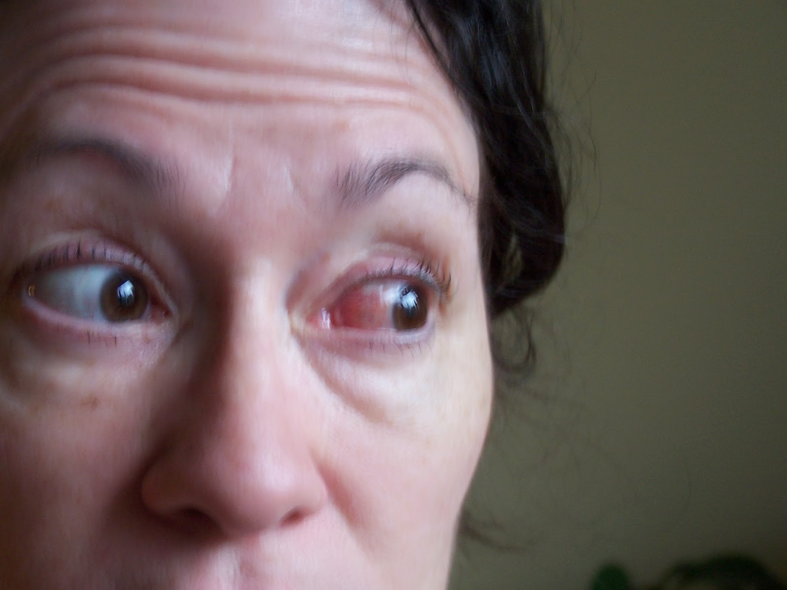 Eye Am Uncomfortable