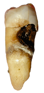 Xing Fu: HAVE YOU HEARD OF TOOTH WORMS?