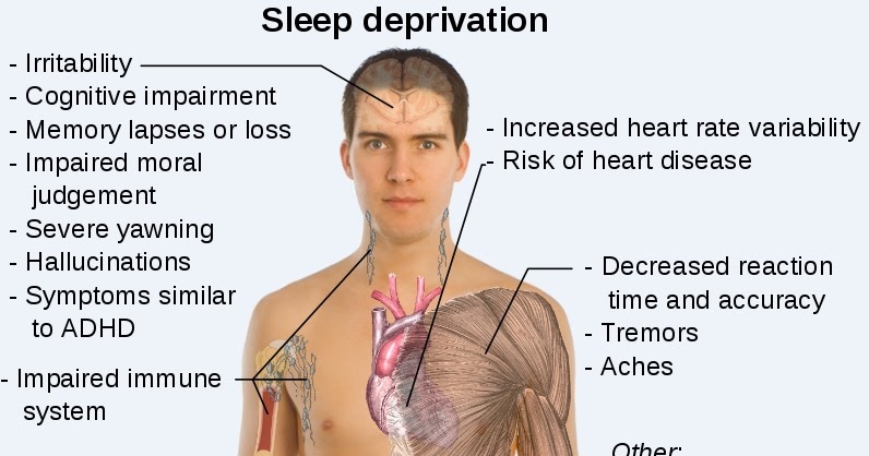 Signs and symptoms of sleep deprivation