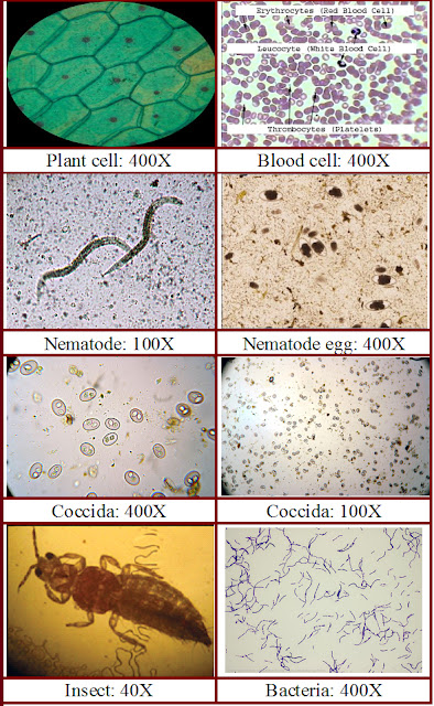 Suri's site.: Choosing a Compound Microscope