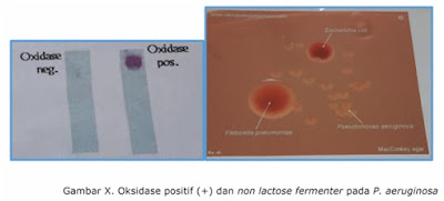 Aprelea Noni: Pseudomonas aeruginosa