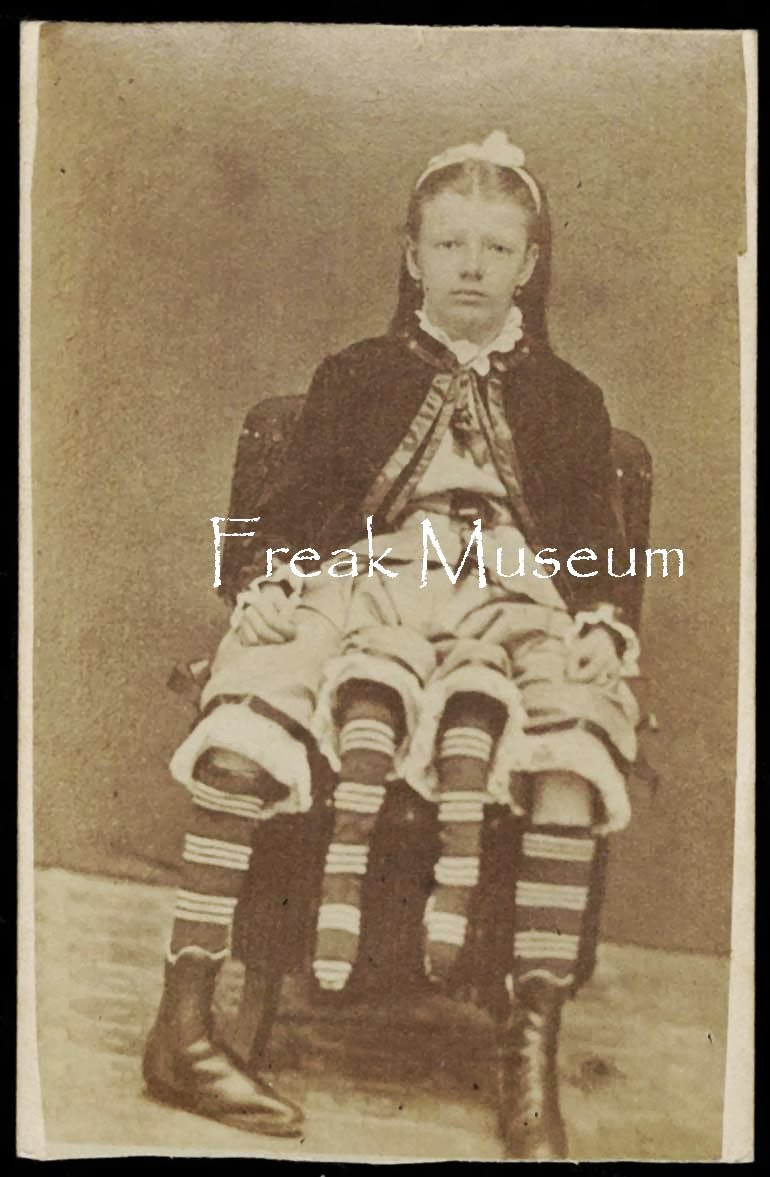 Freak Museum A Private Collection: Freak Photos 19th c.