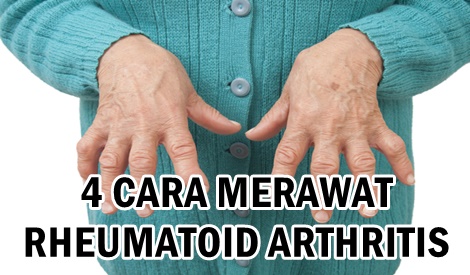 4 CARA MERAWAT RHEUMATOID ARTHRITIS