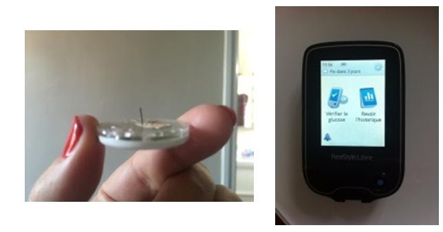 JOÃO PEDRO E O DIABETES: Uma experiência com o FreeStyle Libre