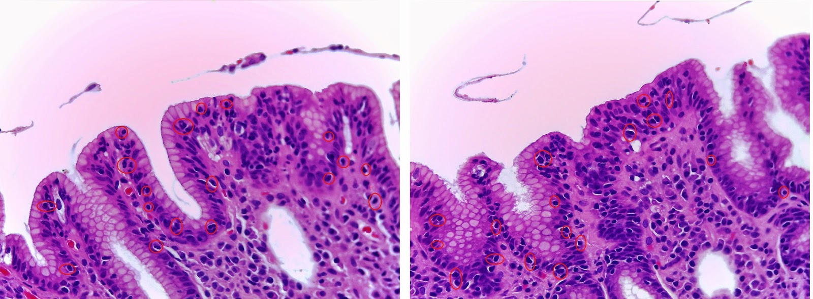 GASTROINTESTINAL AND LIVER HISTOLOGY PATHOLOGY ATLAS: STOMACH ...
