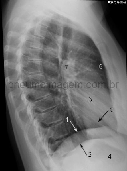 SALUDUCEBOL2011: ANATOMIA RADIOLOGICA