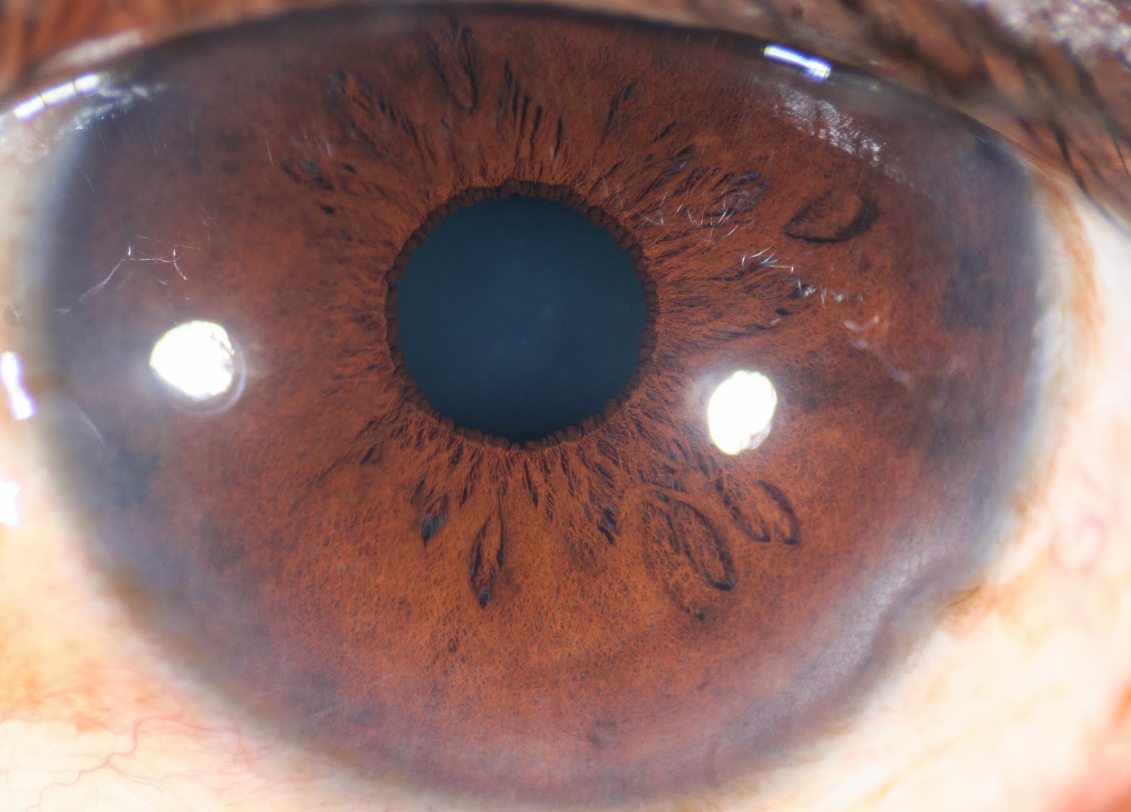 Modern & Multidimensional Iridology: IPB Morphologies, Pupil ...