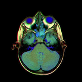 Nevit's blog: Color MRI of the Brain