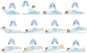 Técnicas de fisioterapia respiratoria