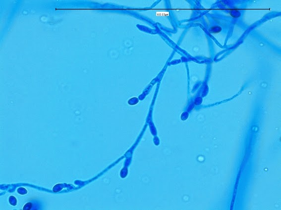 Fun With Microbiology (What's Buggin' You?): Scopulariopsis brumptii