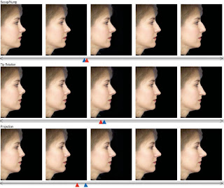 Beauty Tips: Types of nose…