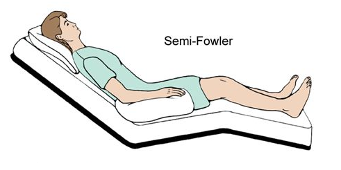 Técnico Em Enfermagem